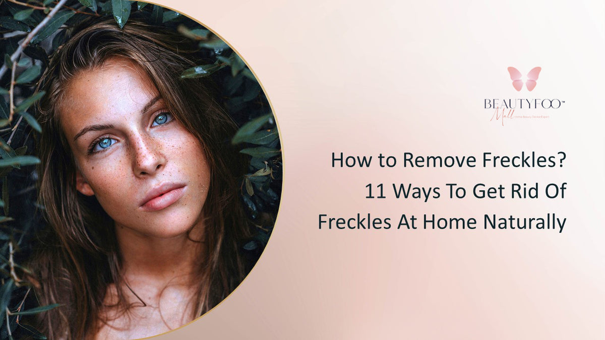 How to Remove Freckles At Home Naturally? - BeautyFoo Mall – Beauty Foo ...